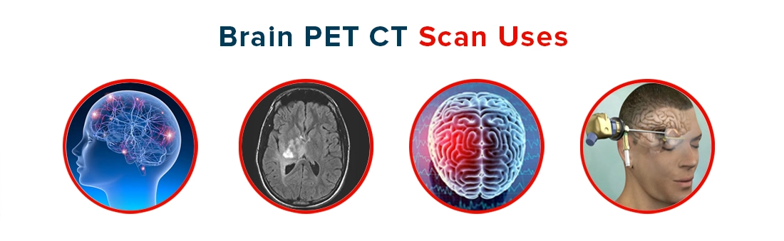 Brain PET CT Scan | Its Uses, Procedure and Risks